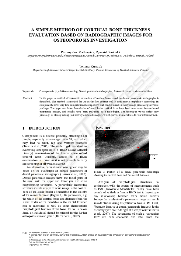(PDF) A Simple Method of Cortical Bone Thickness Evaluation Based on ...