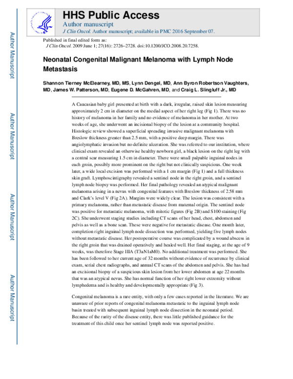 (PDF) Neonatal Congenital Malignant Melanoma With Lymph Node Metastasis