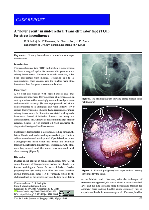 (PDF) A “never event” in mid-urethral Trans obturator tape (TOT) for ...