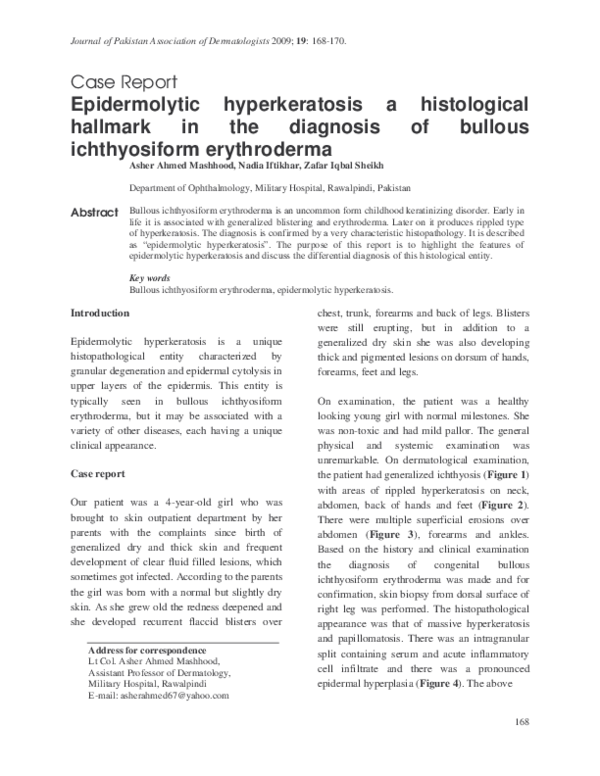 (PDF) Epidermolytic hyperkeratosis a histological hallmark in the ...
