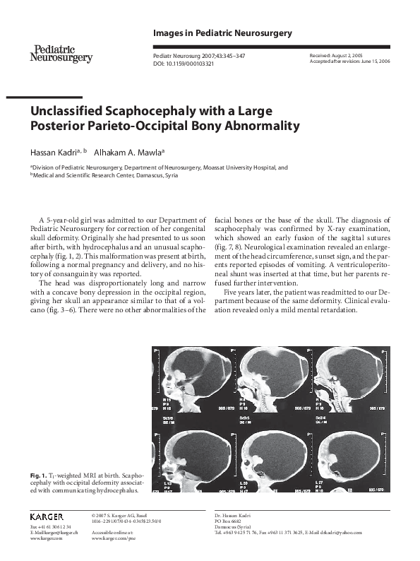 (PDF) Unclassified Scaphocephaly with a Large Posterior Parieto ...
