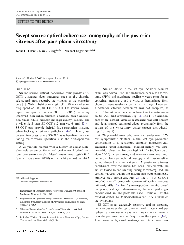 (PDF) Swept source optical coherence tomography of the posterior ...