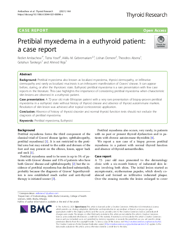 (PDF) Pretibial myxedema in a euthyroid patient: a case report