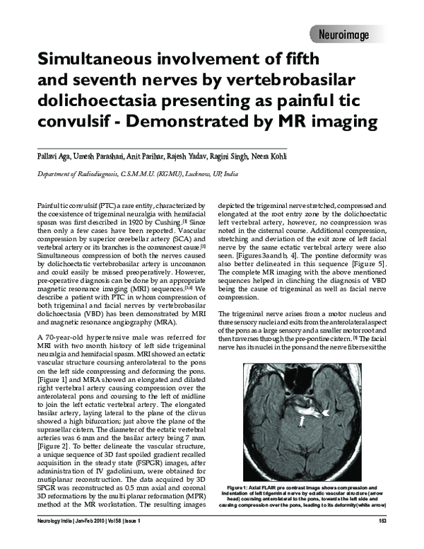 (PDF) Simultaneous involvement of fifth and seventh nerves by ...