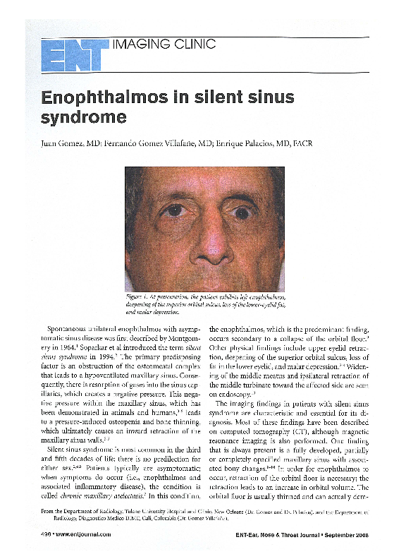 (PDF) Enophthalmos in Silent Sinus Syndrome | Enrique Palacios ...