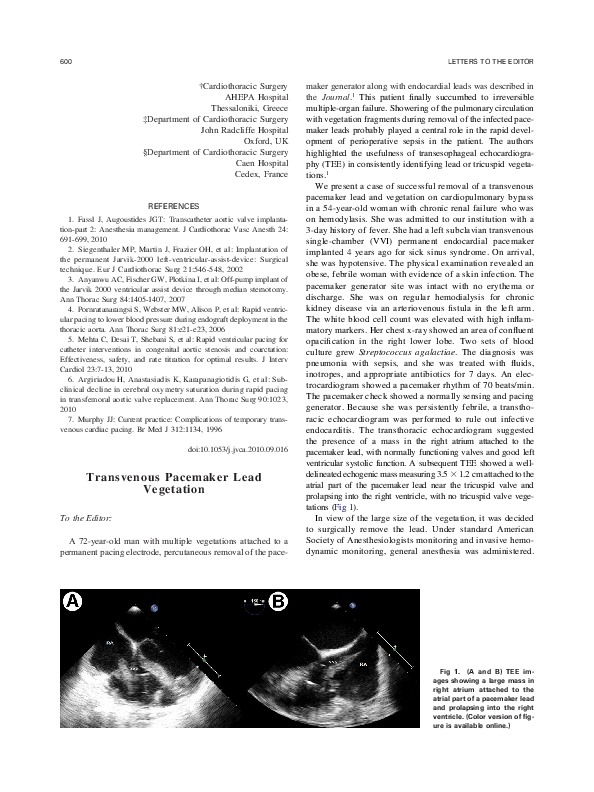 (PDF) Transvenous Pacemaker Lead Vegetation