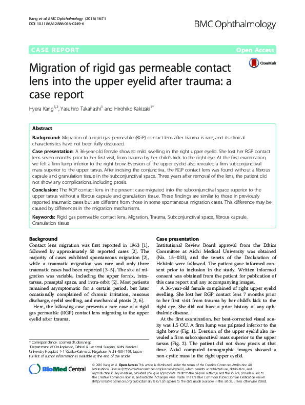 (PDF) Migration of rigid gas permeable contact lens into the upper ...