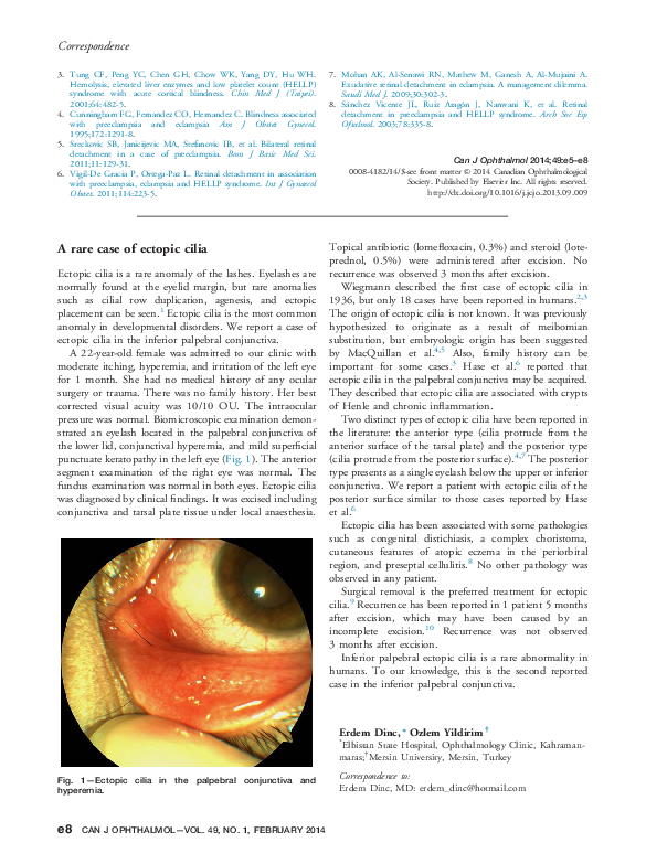 (PDF) A rare case of ectopic cilia | Erdem Dinç - Academia.edu