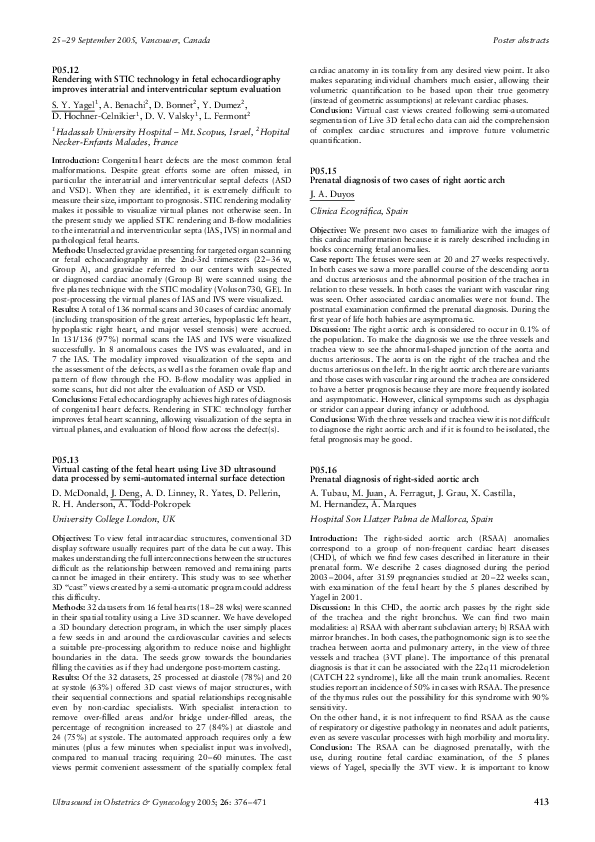 (PDF) P05.12: Rendering with STIC technology in fetal echocardiography ...