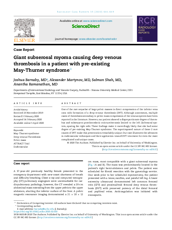 (PDF) Giant subserosal myoma causing deep venous thrombosis in a ...