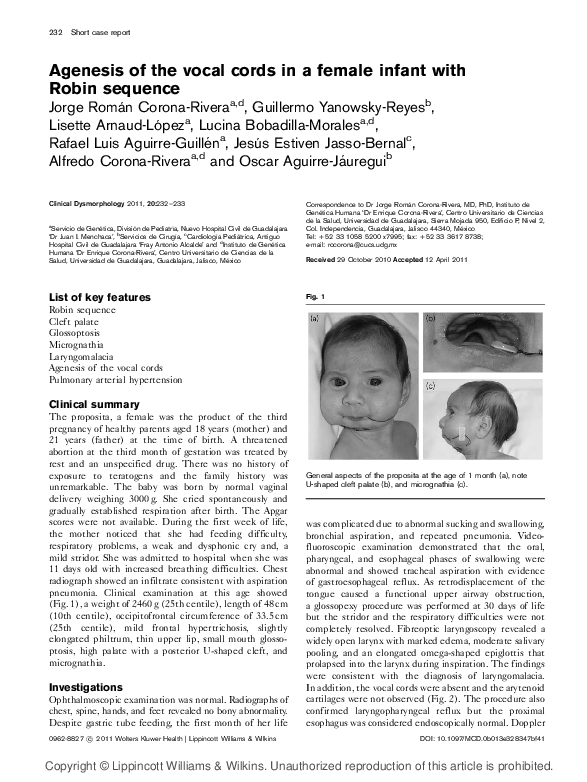 Agenesis of the vocal cords in a female infant with Robin sequence