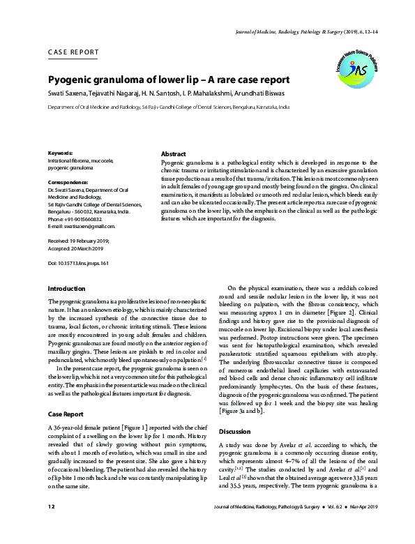 Pdf Pyogenic Granuloma Of Lower Lip A Rare Case Report