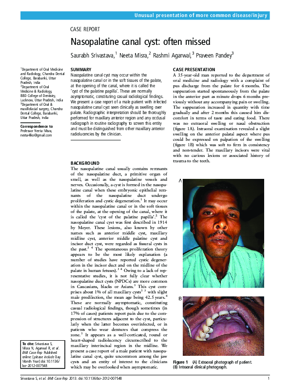 (PDF) Nasopalatine canal cyst: often missed