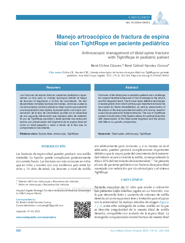 (PDF) Manejo artroscópico de fractura de espina tibial con TightRope en ...