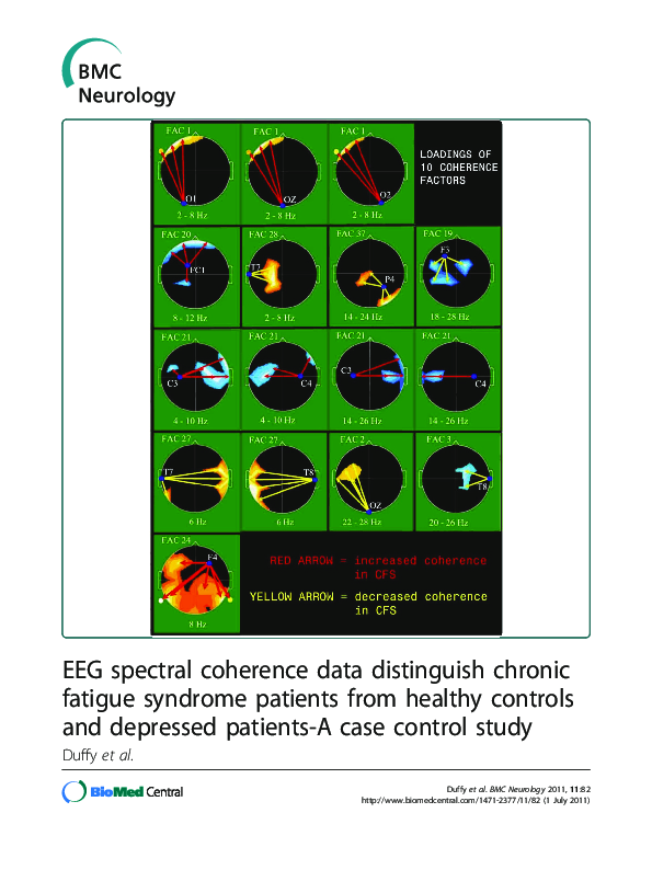(PDF) EEG spectral coherence data distinguish chronic fatigue syndrome ...