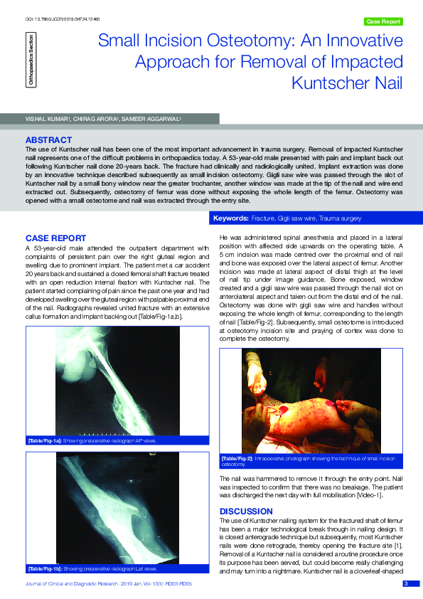 (PDF) Small Incision Osteotomy: An Innovative Approach for Removal of Impacted Kuntscher Nail