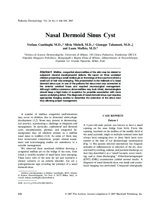 (PDF) Nasal Dermoid Sinus Cyst