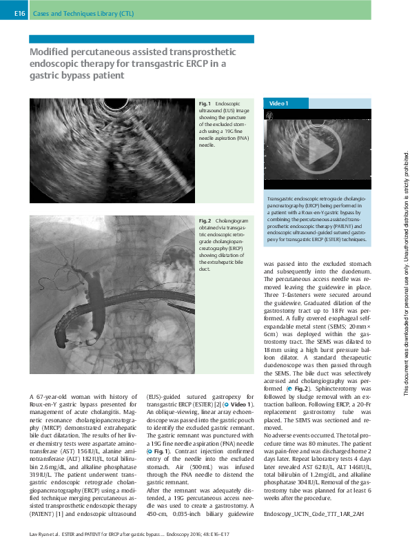 (PDF) Modified percutaneous assisted transprosthetic endoscopic therapy ...