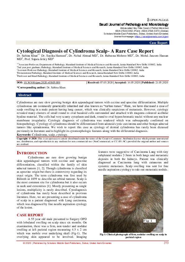 (PDF) Cytological Diagnosis of Cylindroma Scalp- A Rare Case Report