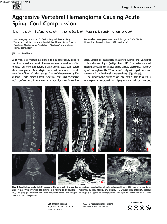 (PDF) Aggressive Vertebral Hemangioma Causing Acute Spinal Cord Compression