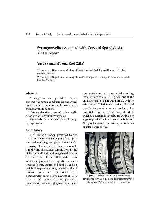 (PDF) Syringomyelia associated with Cervical Spondylosis: A case report