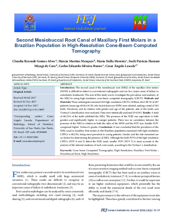 Second Mesiobuccal Root Canal of Maxillary First Molars in a Brazilian ...