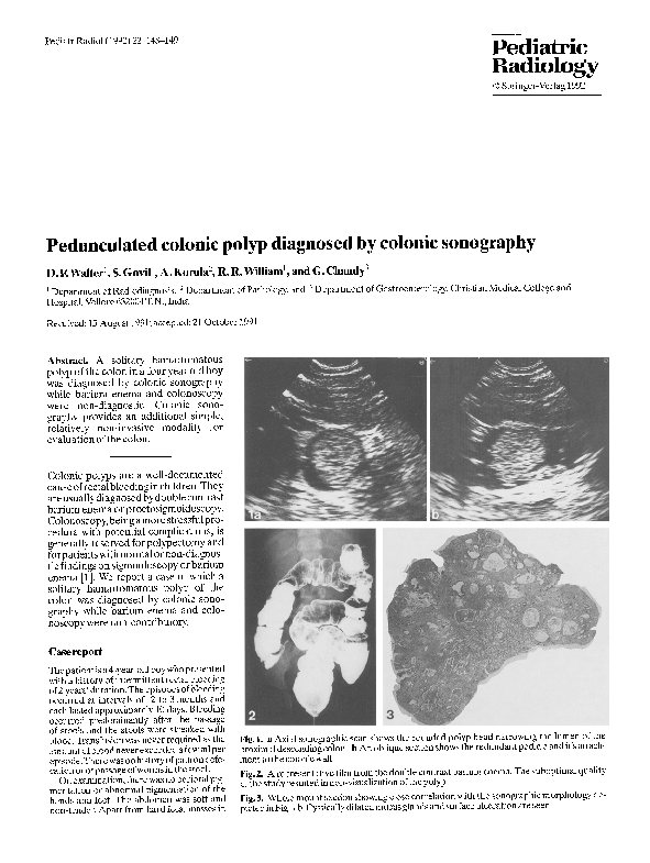 (PDF) Pedunculated colonic polyp diagnosed by colonic sonography ...