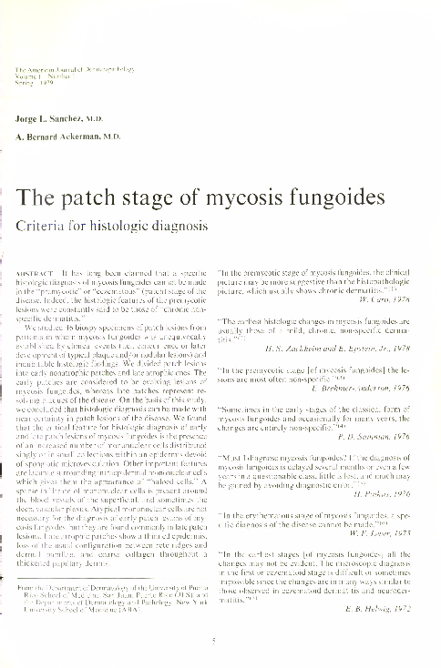 (PDF) The patch stage of mycosis fungoides Criteria for histologic ...