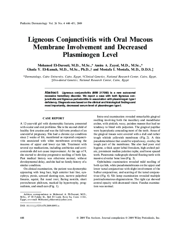 (PDF) Ligneous Conjunctivitis with Oral Mucous Membrane Involvement and ...