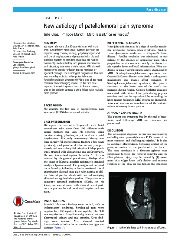 (PDF) New aetiology of patellofemoral pain syndrome