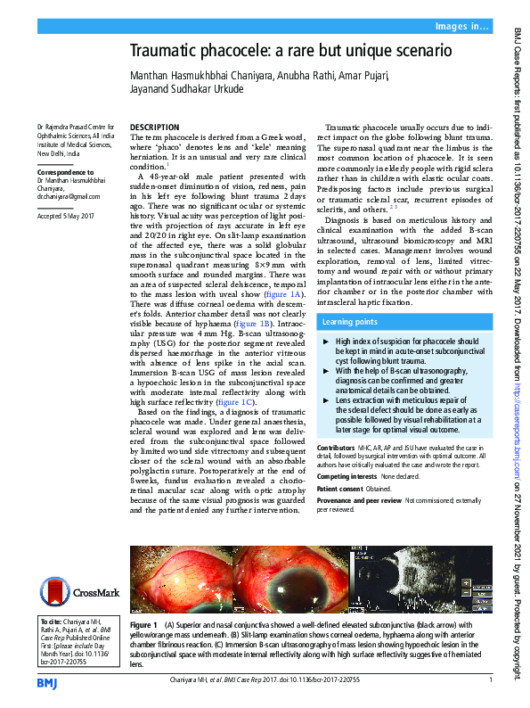 (PDF) Traumatic phacocele: a rare but unique scenario