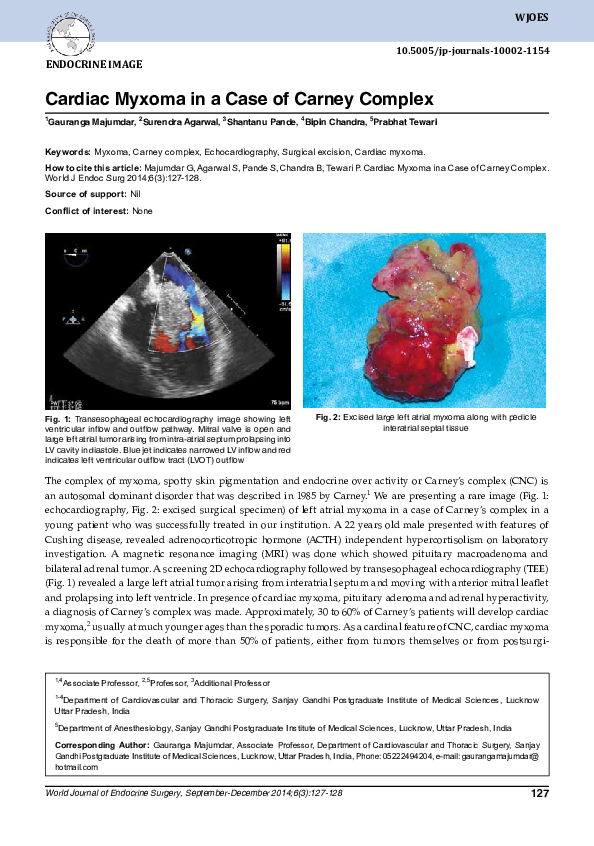 (PDF) Cardiac Myxoma in a case of Carney Complex