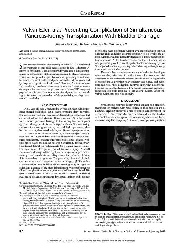 (PDF) Vulvar Edema as Presenting Complication of Simultaneous Pancreas ...