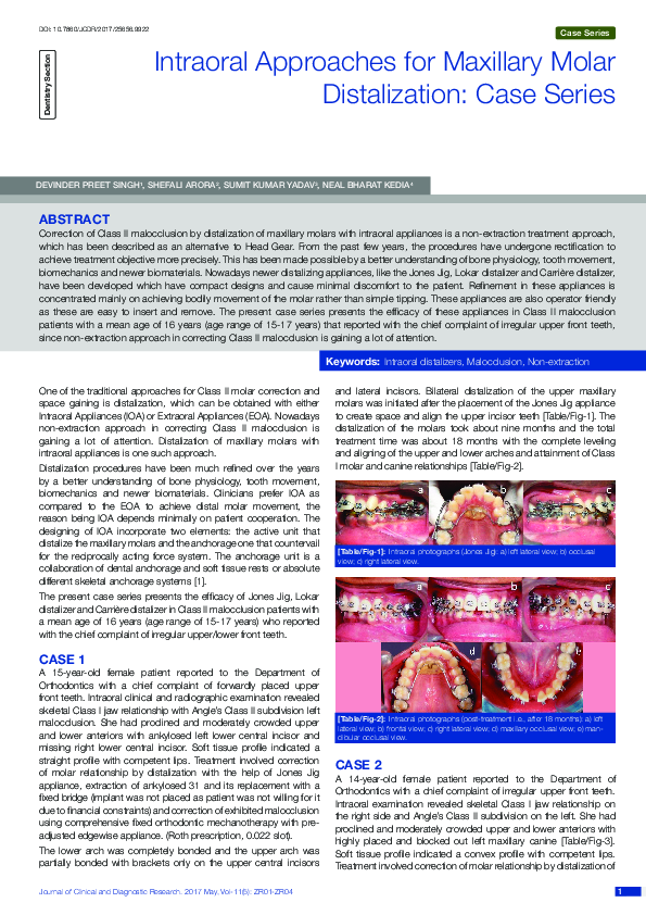(PDF) Intraoral Approaches for Maxillary Molar Distalization: Case Series