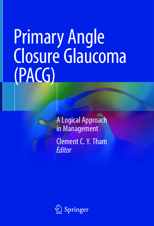 (PDF) Primary Angle Closure Glaucoma (PACG): A Logical Approach Base on ...