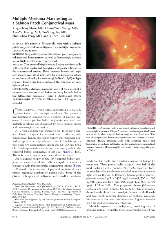 (PDF) Multiple Myeloma Manifesting as a Salmon Patch Conjunctival Mass