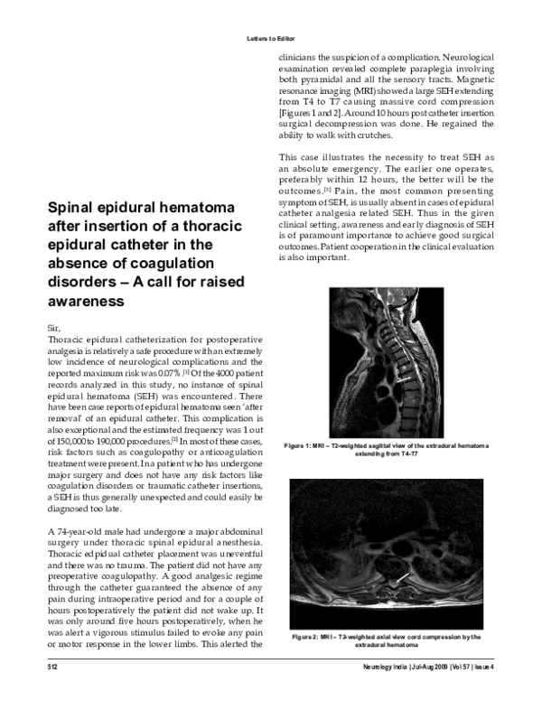 (PDF) Spinal epidural hematoma after insertion of a thoracic epidural catheter in the absence of ...