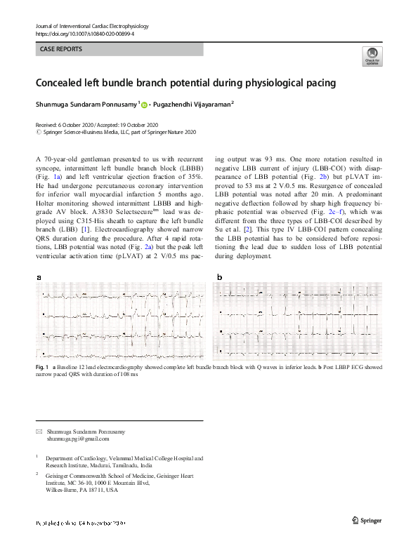 (PDF) Concealed left bundle branch potential during physiological pacing