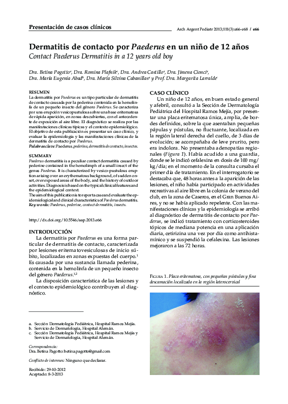 (PDF) Dermatitis de contacto por Paederus en un niño de 12 años