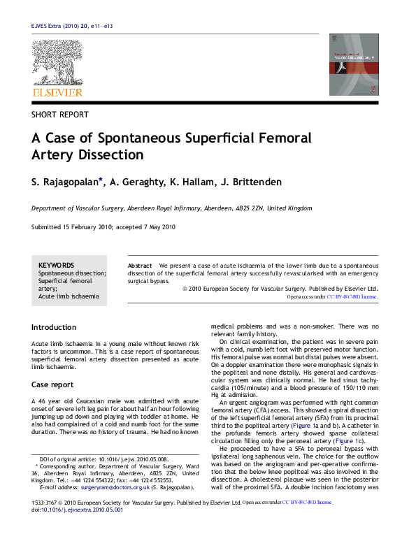 A Case of Spontaneous Superficial Femoral Artery Dissection