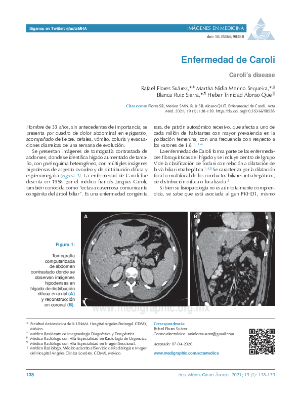 (PDF) Enfermedad de Caroli