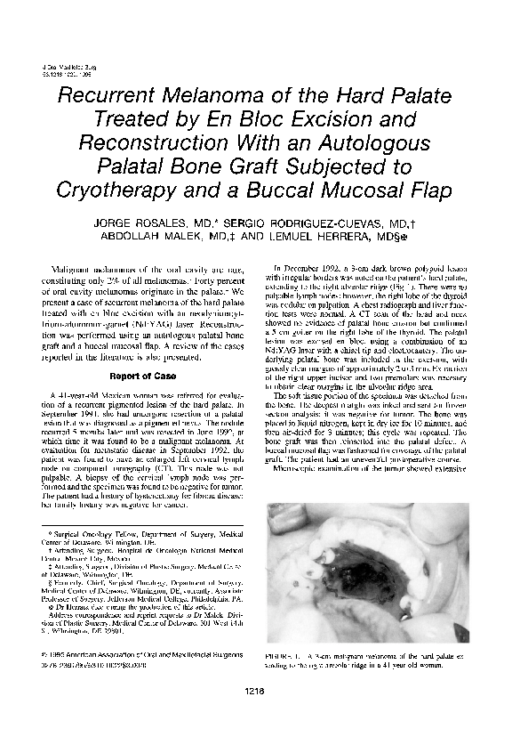 (PDF) Recurrent melanoma of the hard palate treated by en bloc excision ...