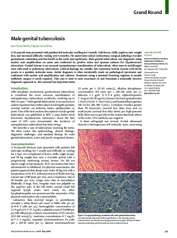 (PDF) Male genital tuberculosis