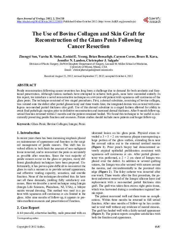 (PDF) The Use of Bovine Collagen and Skin Graft for Reconstruction of ...