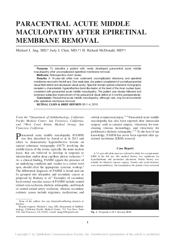 (PDF) Paracentral Acute Middle Maculopathy After Epiretinal Membrane ...