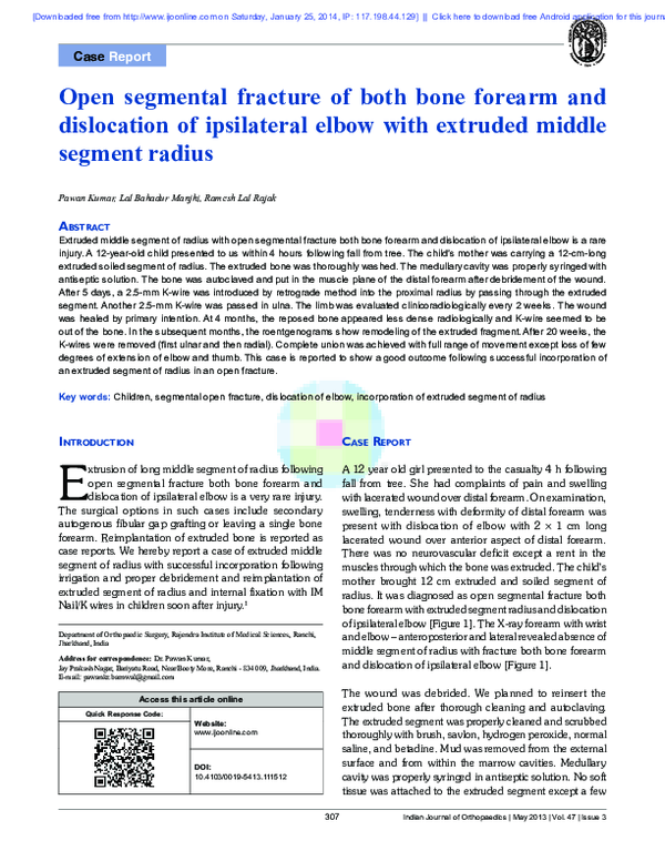 Pdf Open Segmental Fracture Of Both Bone Forearm And Dislocation Of Ipsilateral Elbow With