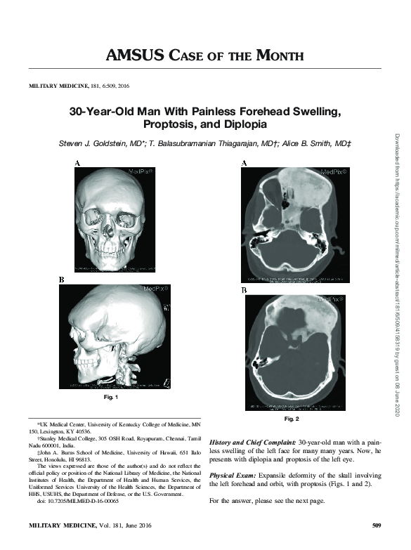 (PDF) 30-Year-Old Man With Painless Forehead Swelling, Proptosis, and ...