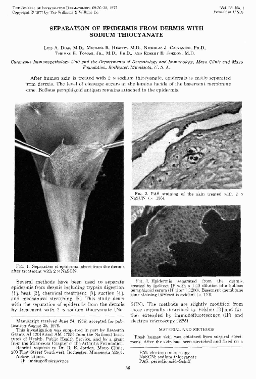 (PDF) Separation of Epidermis from Dermis with Sodium Thiocyanate