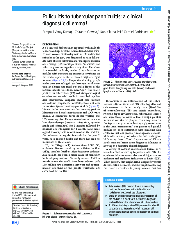 (PDF) Folliculitis to tubercular panniculitis: a clinical diagnostic ...