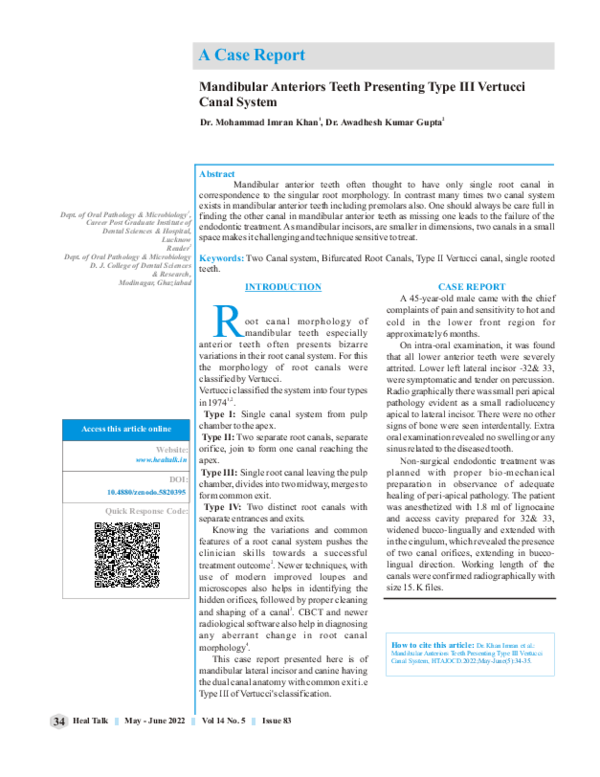 (PDF) Mandibular Anteriors Teeth Presenting Type III Vertucci Canal System
